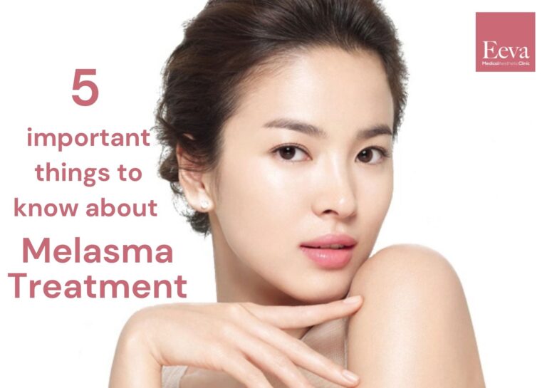 5 Important Things You Need To Know About Melasma Treatment | Eeva ...