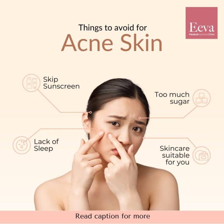 What is Acne? Explained - Prevention, Causes and Treatments | Eeva ...