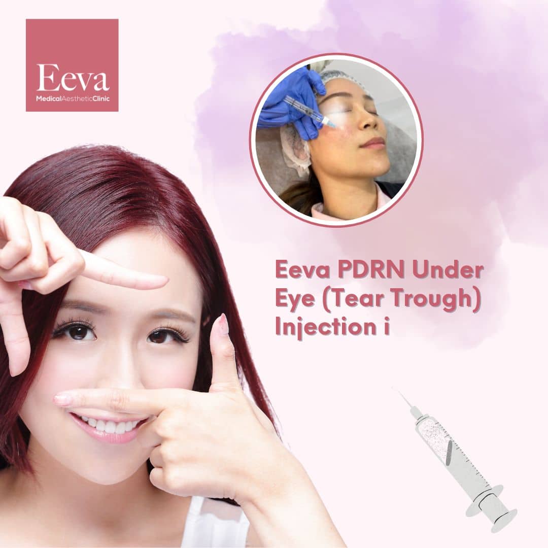Tear Trough Filler Under Eye | Eeva Medical Clinic