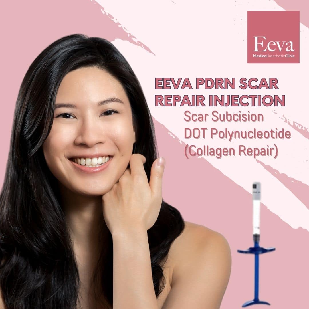 Acne Scar Removal Clinic in Singapore | Eeva Medical Clinic