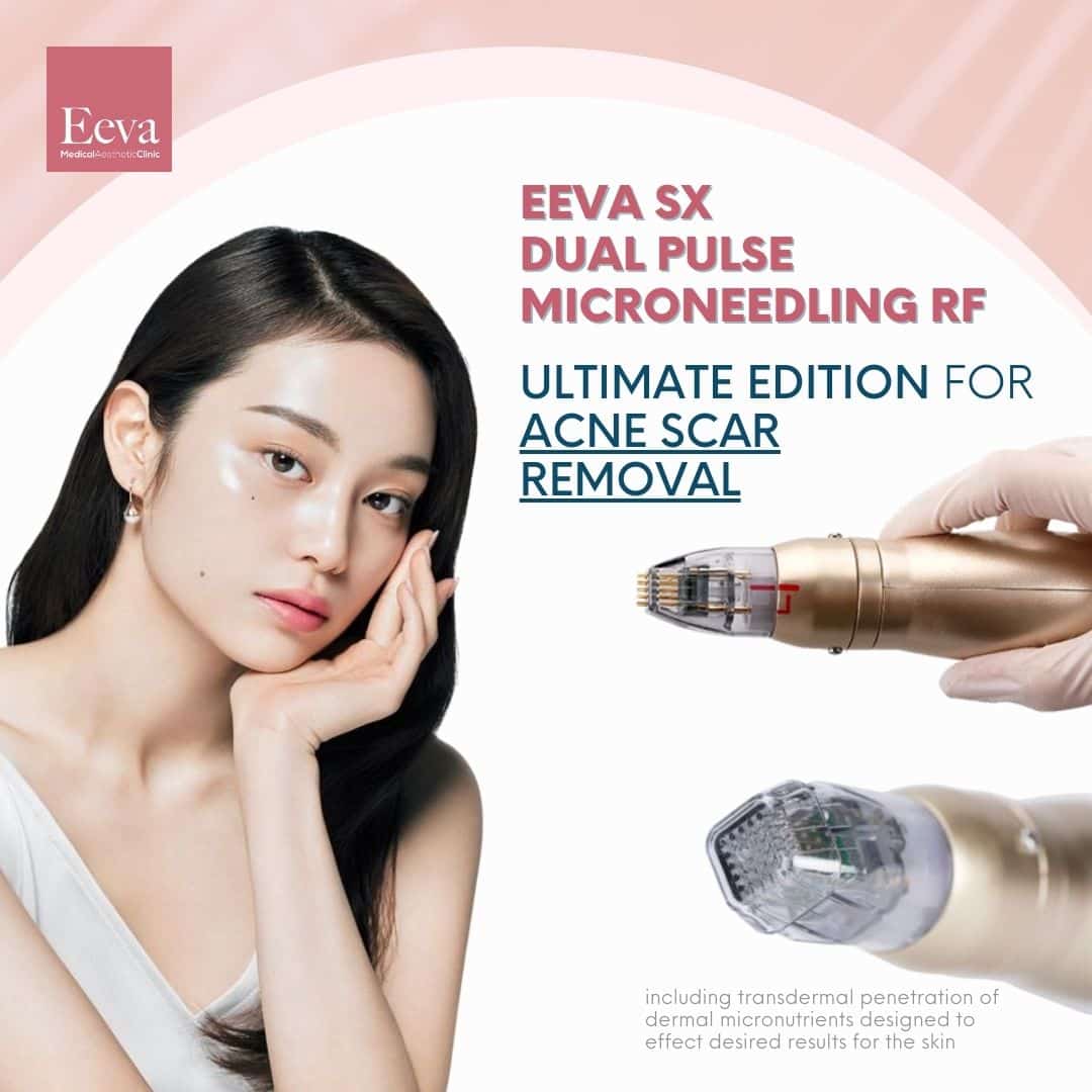 Acne Scar Removal Clinic in Singapore | Eeva Medical Clinic