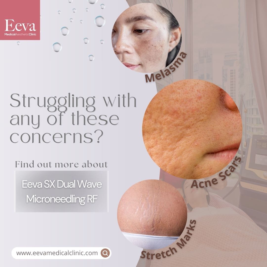 Eeva SX Dual Wave Microneedling RF Treatment Singapore